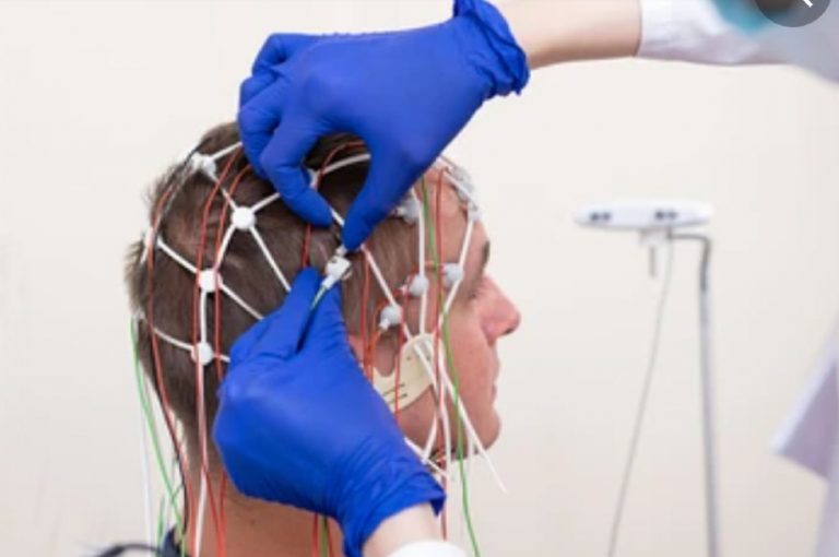 How can we better treat Alzheimer's disease and diagnose its early ...