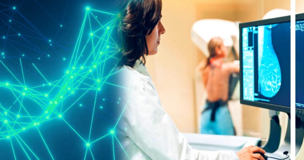 [Dossier] IA et cancérologie : La promesse d'une révolution des soins ...